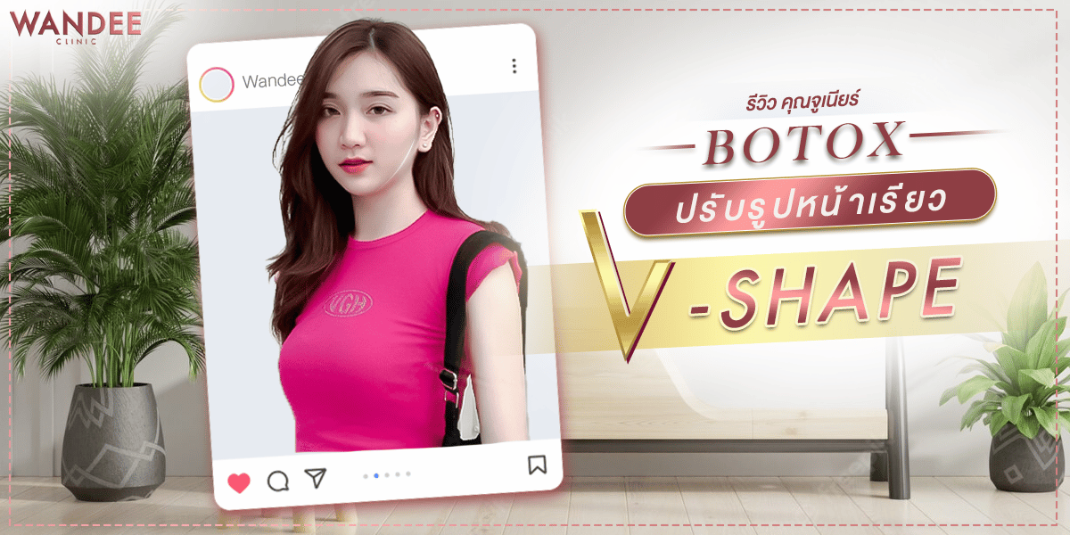 Botox ลดกราม หน้าเรียว V-Shape จากคุณจูเนียร์ สำหรับคนที่อยากหน้าเรียว