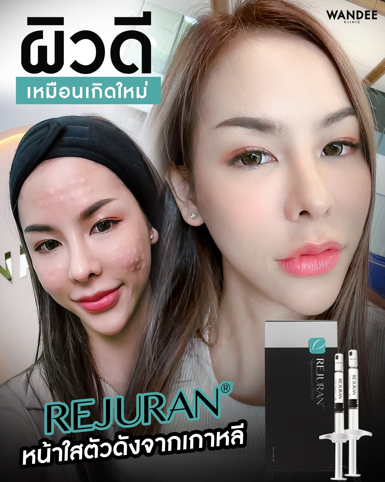 #ผิวดีเหมือนเกิดใหม่ ต้องยกให้ 𝐑𝐄𝐉𝐔𝐑𝐀𝐍 งานดี!บำรุงหน้าใส