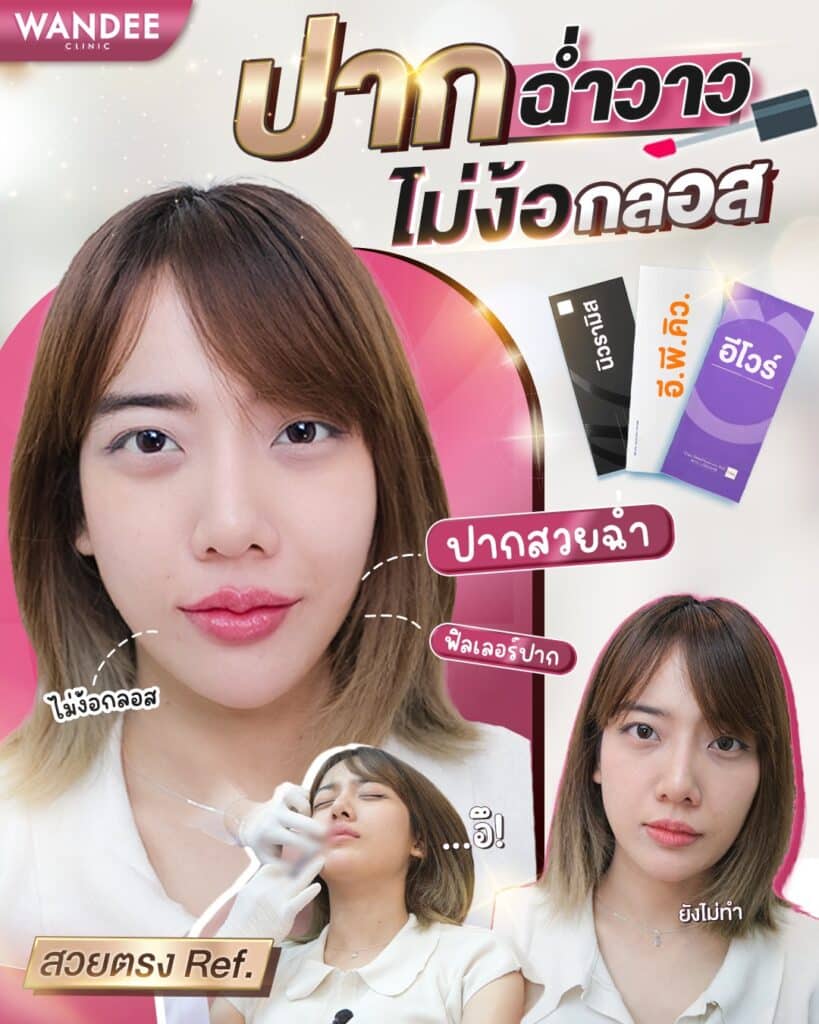 ปากฉ่ำวาว ไม่ง้อกลอส สวยจึ้งถูกใจตรงเรฟสุด ๆ ด้วย 𝗣𝗿𝗼𝗴𝗿𝗮𝗺 𝗙𝗶𝗹𝗹𝗲𝗿 ปาก เปลี่ยนปากแห้งให้สวยฉ่ำ ...