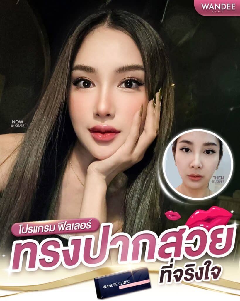 แฉความลับ! ปากสวยน่าจุ๊บแบบนี้ จบที่ 𝗣𝗿𝗼𝗴𝗿𝗮𝗺 𝗙𝗶𝗹𝗹𝗲𝗿 ปาก