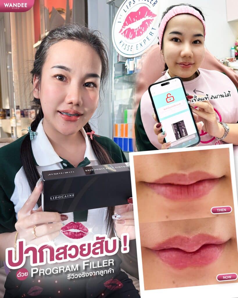 รีวิวจากลูกค้าจริง 𝗣𝗿𝗼𝗴𝗿𝗮𝗺 𝗙𝗶𝗹𝗹𝗲𝗿 ปากสวยละมุน ใครเห็นก็ต้องหลงรัก