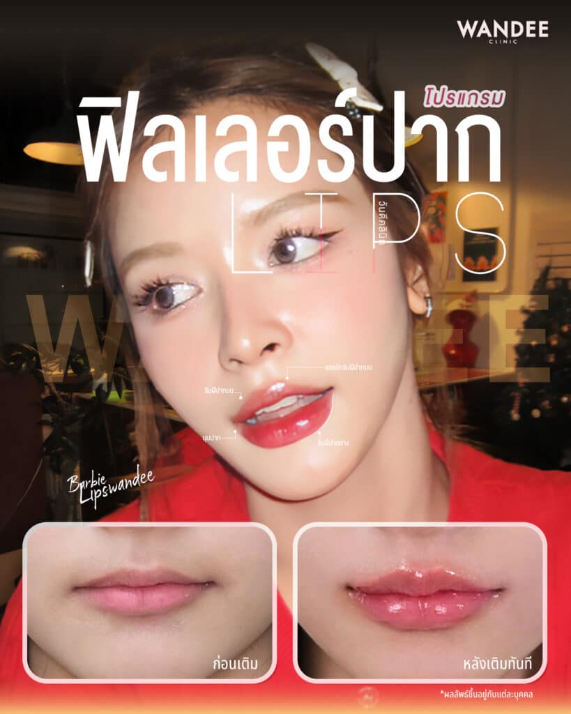 เติมเสน่ห์ให้ปาก ดูน่าจุ๊บกว่าเดิม เพราะทำ 𝗣𝗿𝗼𝗴𝗿𝗮𝗺 𝗙𝗶𝗹𝗹𝗲𝗿 ปาก