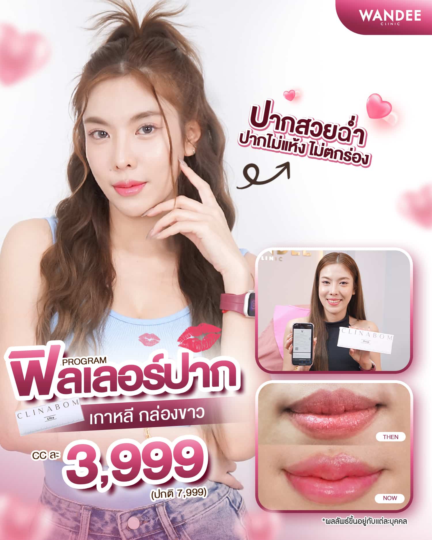 ปากดูดี มีชัยไปกว่าครึ่ง เพราะทำ 𝗣𝗿𝗼𝗴𝗿𝗮𝗺 𝗙𝗶𝗹𝗹𝗲𝗿 ปาก เกาหลี กล่องขาว - WandeeClinic วันดี คลินิก ...