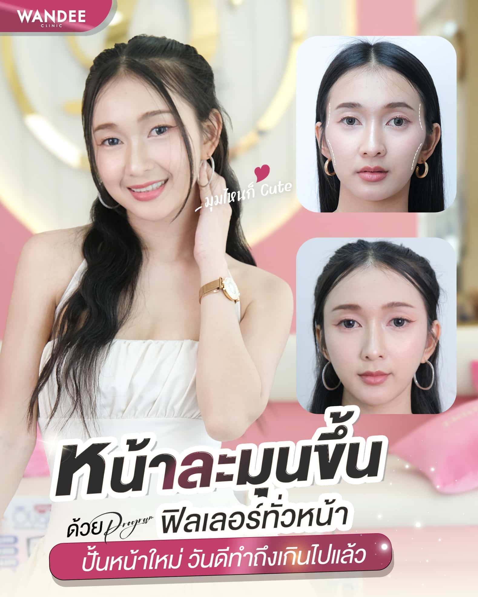 หน้าละมุนขึ้นทุกองศา 𝗣𝗿𝗼𝗴𝗿𝗮𝗺 𝗙𝗶𝗹𝗹𝗲𝗿 ทั่วหน้า แก้ปัญหาตรงจุด ...