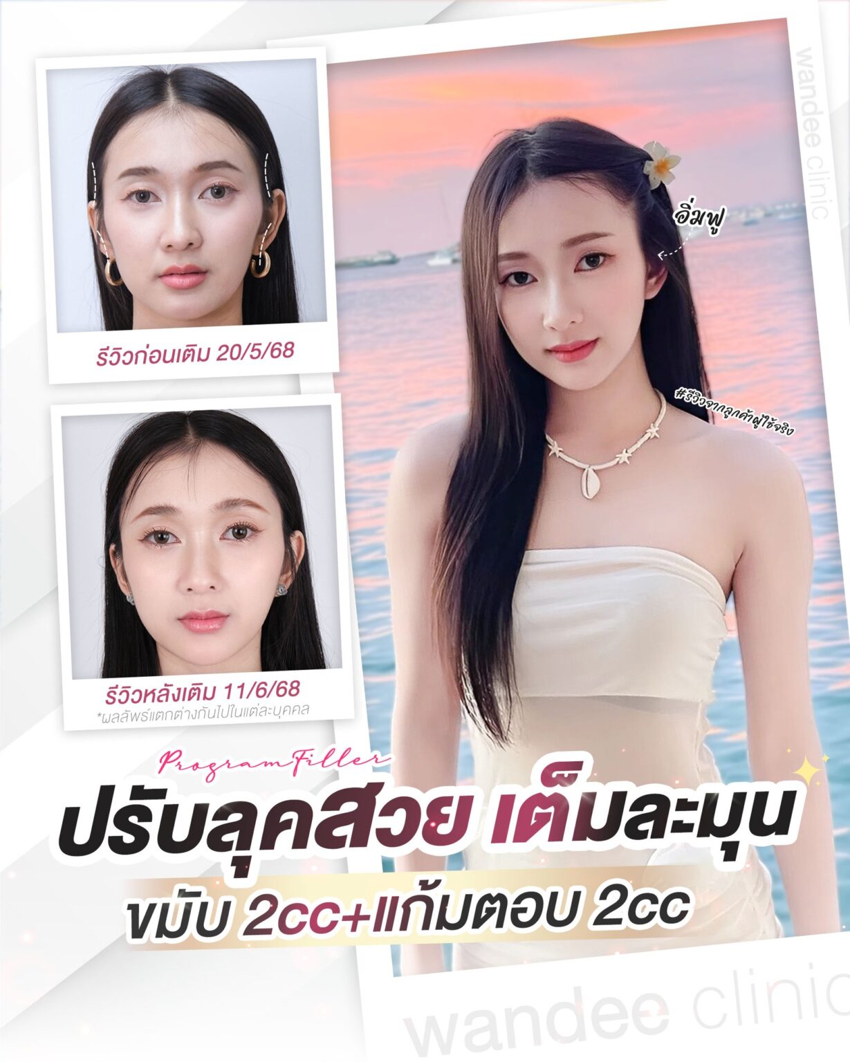 ปรับลุคสวย เต็มละมุน เพียงเติมขมับ 𝟮𝗰𝗰 + แก้ม 𝟮𝗰𝗰